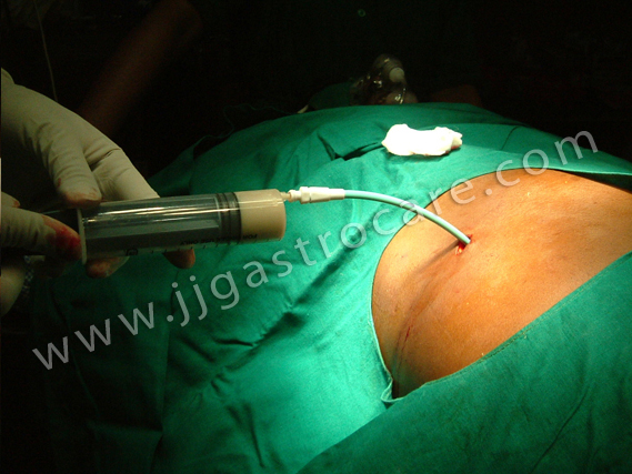 Dr Joshy John. Senior gastrointestinal surgeon